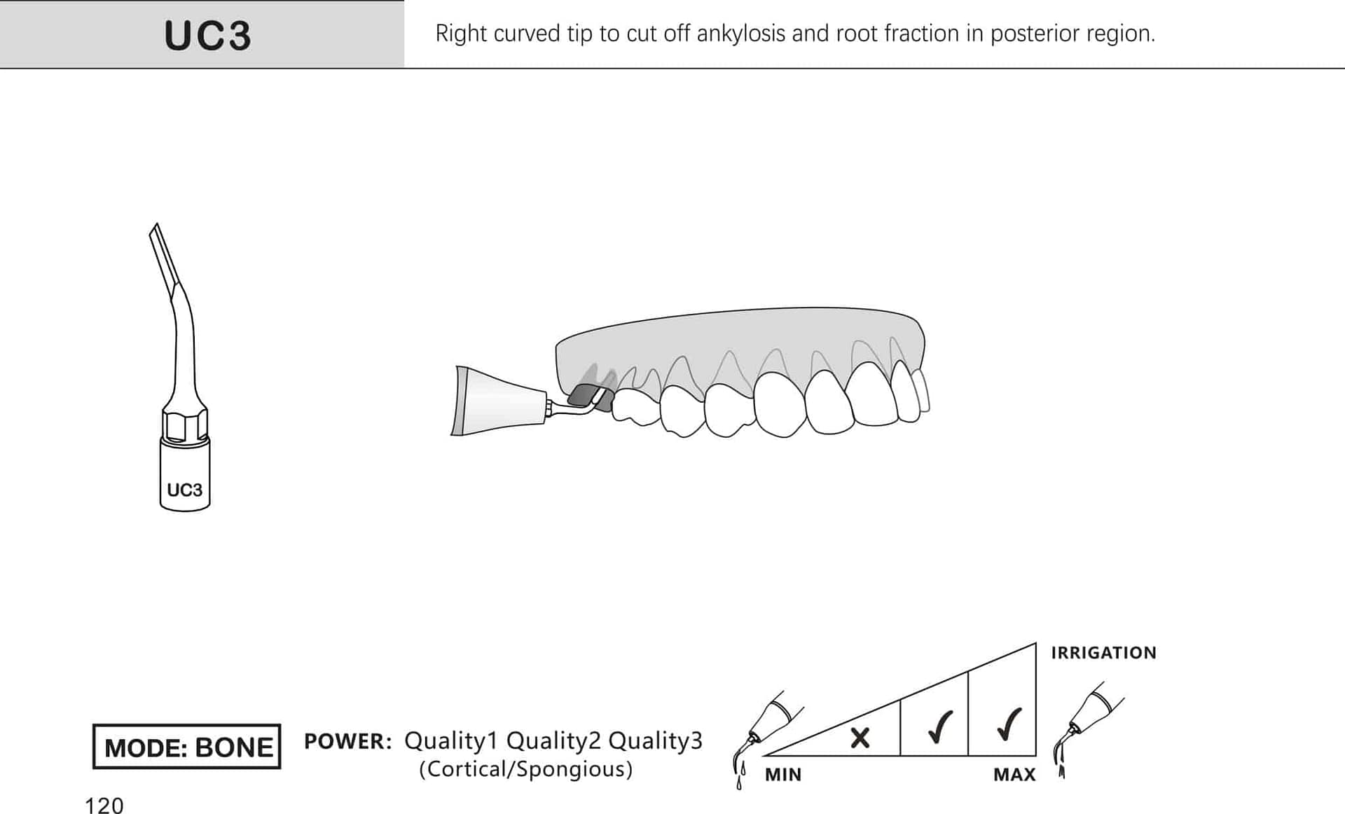 Extraction | Ultrasurgery Tip UC3 | Just 34$| CE FDA certificate.